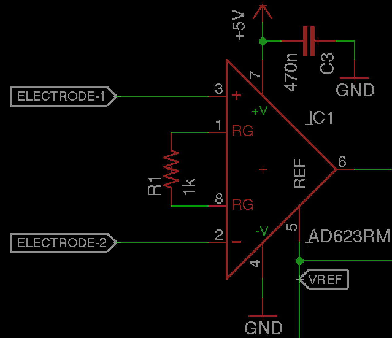 Super Simple Electrocardiogram (ECG) Circuit : 11 Steps (with Pictures ...