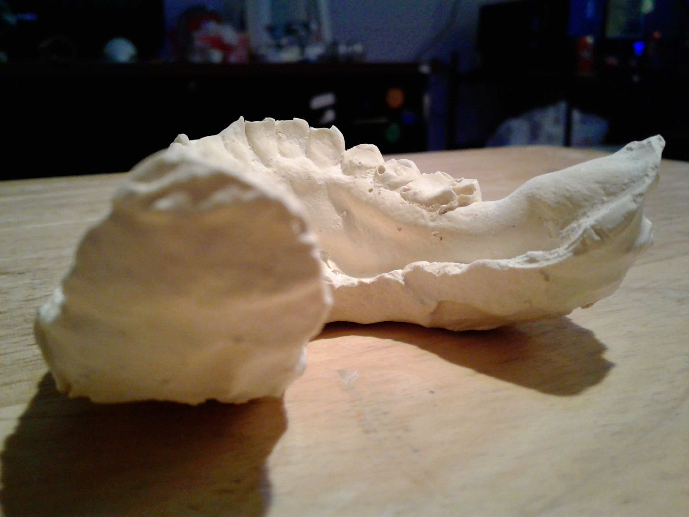 DIY Dentures : a Post-Surgical Plan : 12 Steps (with Pictures ...