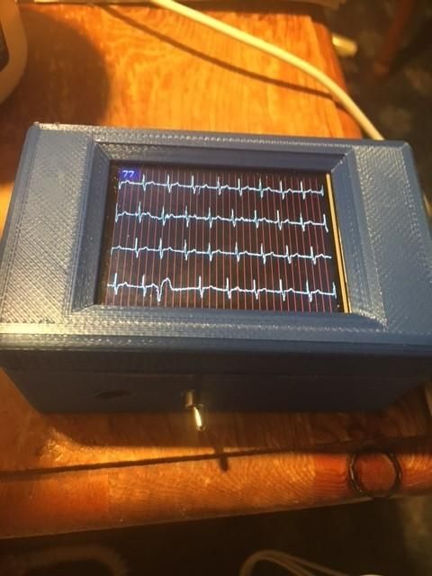 ECG Display With Arduino : 13 Steps (with Pictures) - Instructables