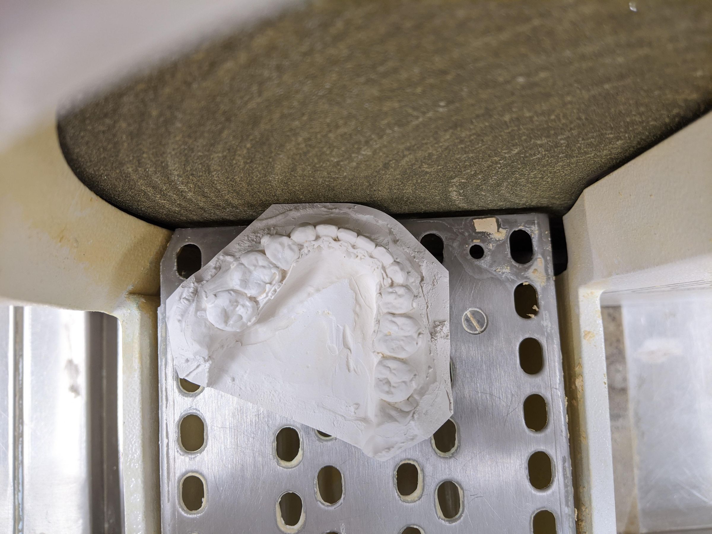 A New Method for Trimming Orthodontic Study Model : 8 Steps - Instructables