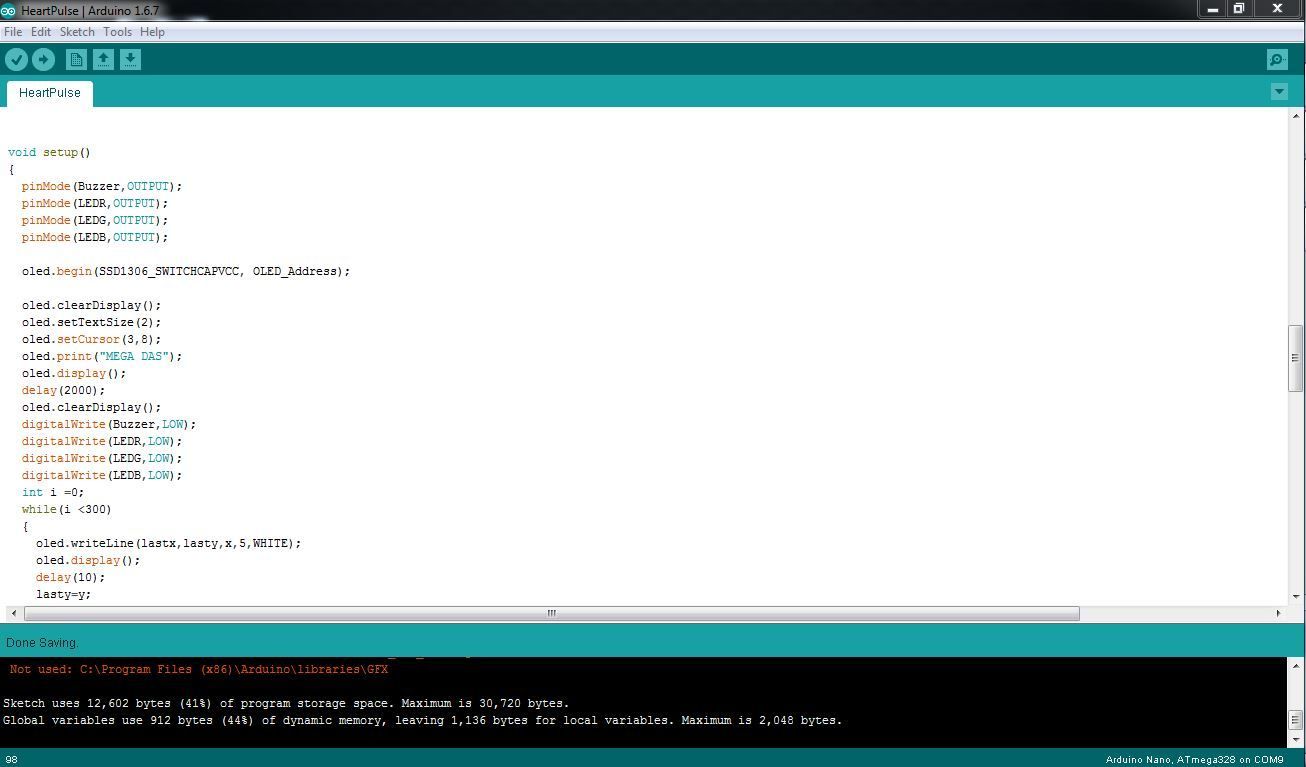 Arduino Heart Beat With ECG Display & Sound : 7 Steps - Instructables