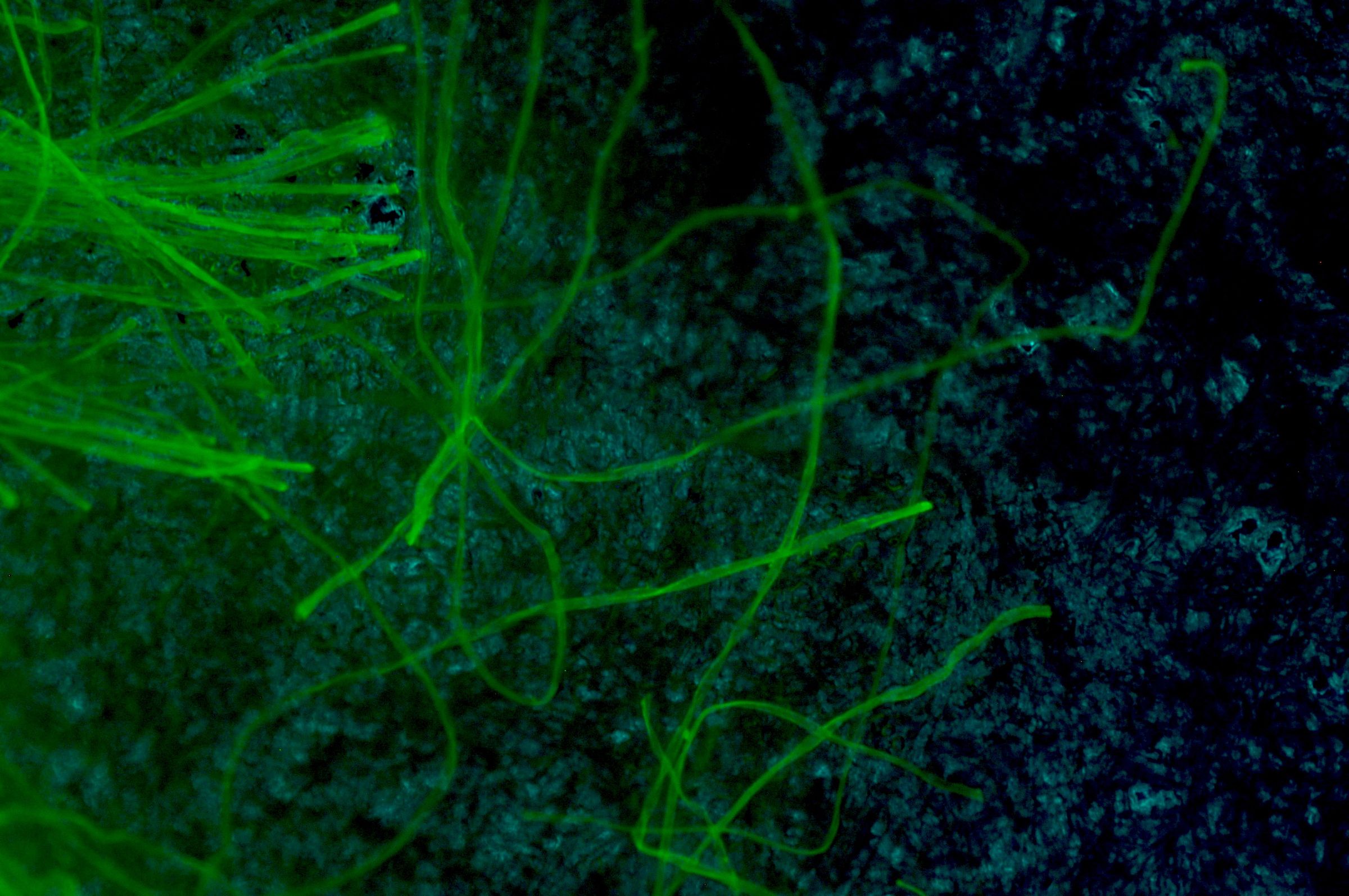 Low-cost Fluorescence and Brightfield Microscopes : 9 Steps (with ...