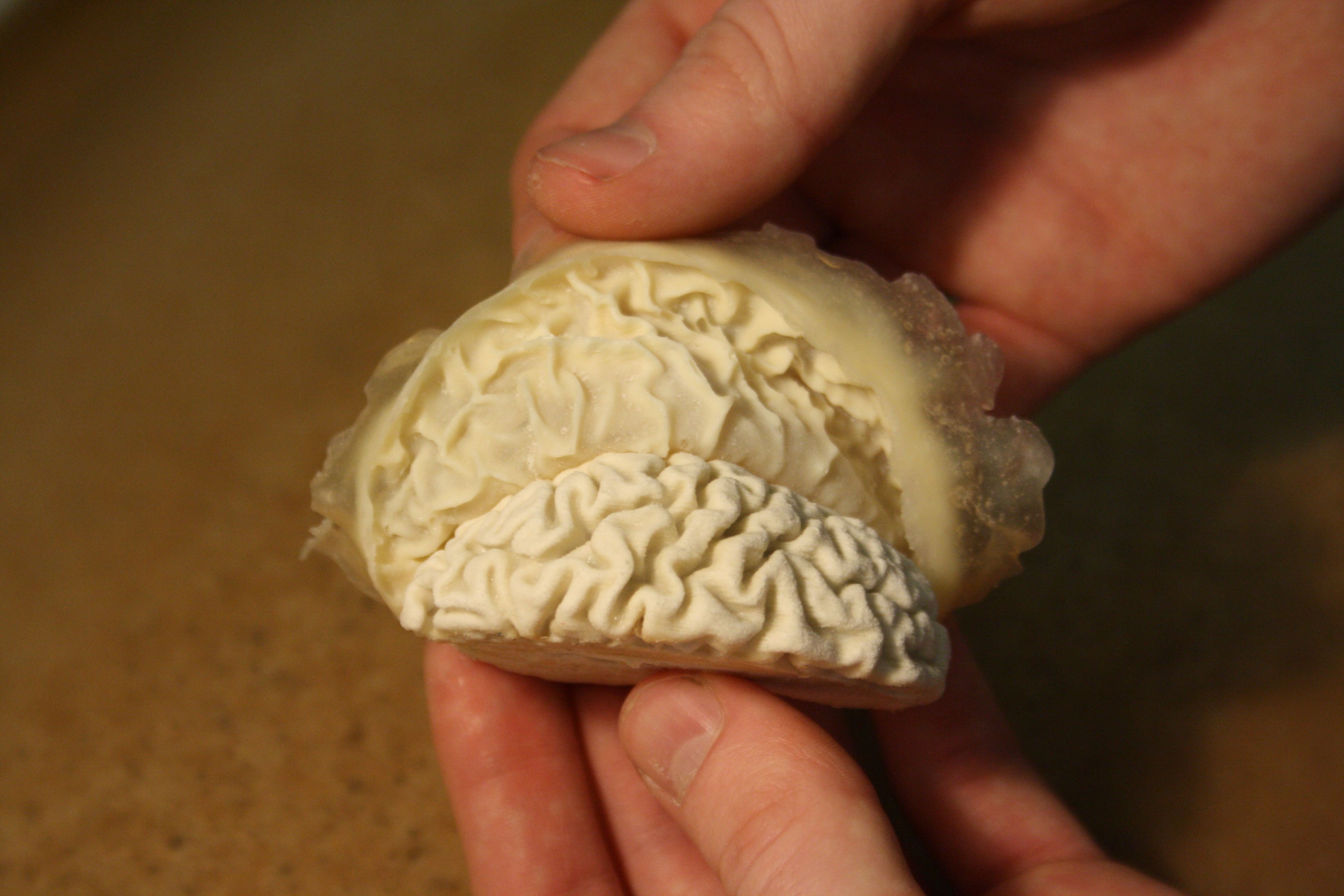 Edible Chocolate Brain From MRI Scan : 9 Steps (with Pictures ...