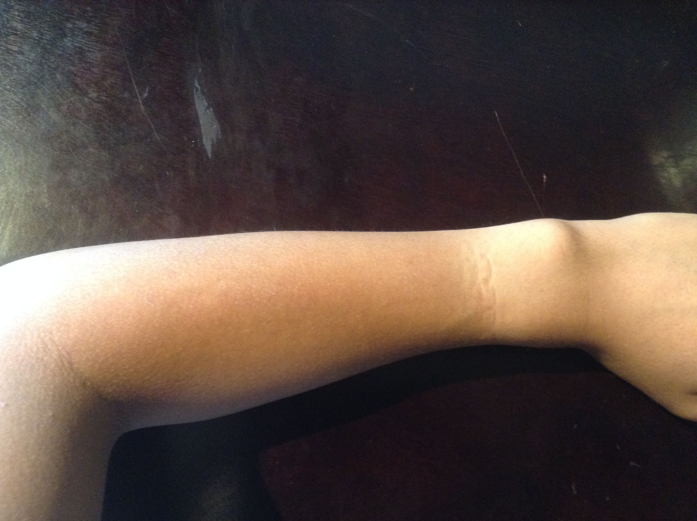 How to Scrape Your Arm : 5 Steps - Instructables