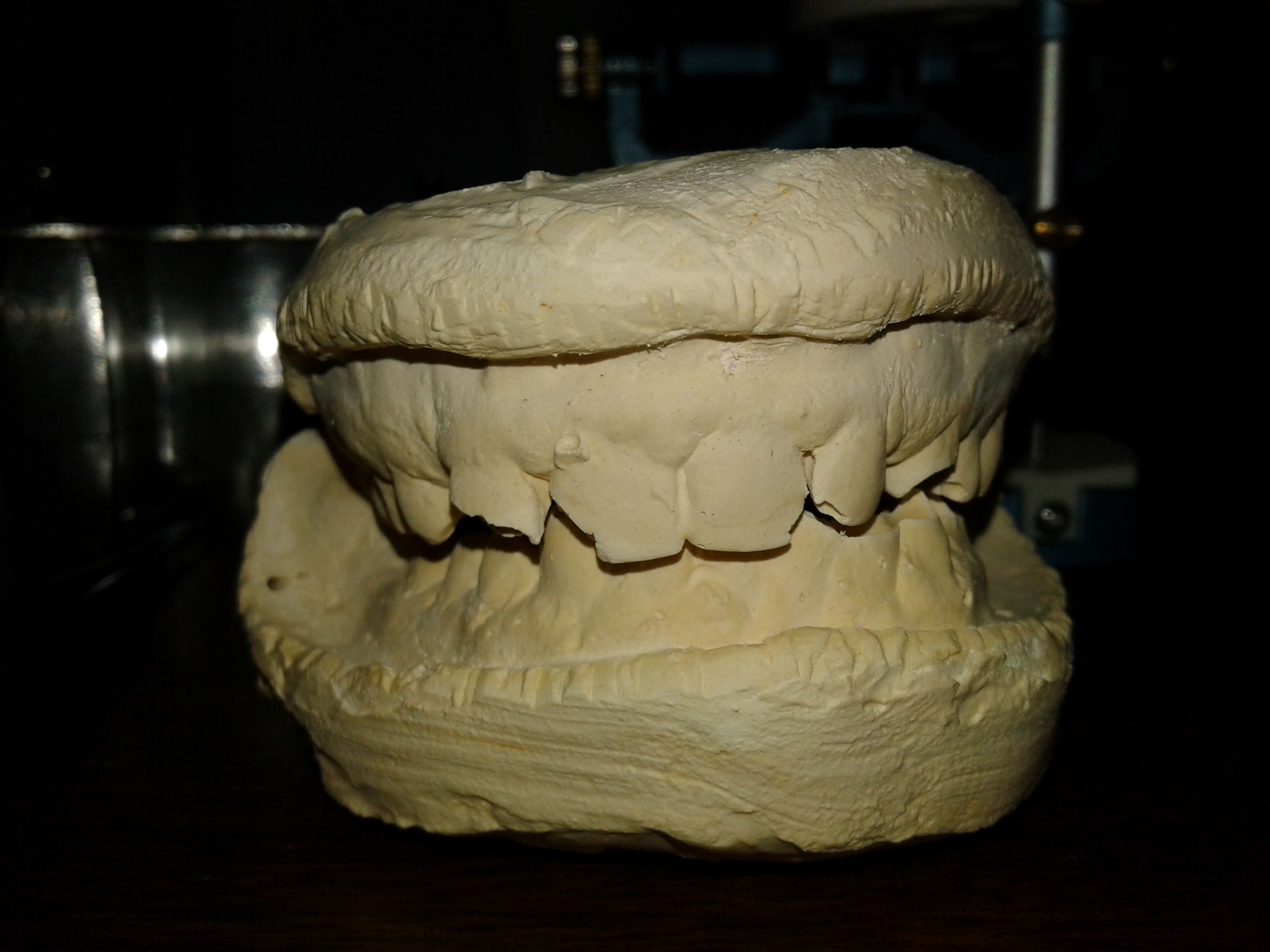 DIY Dentures : a Post-Surgical Plan : 12 Steps (with Pictures ...