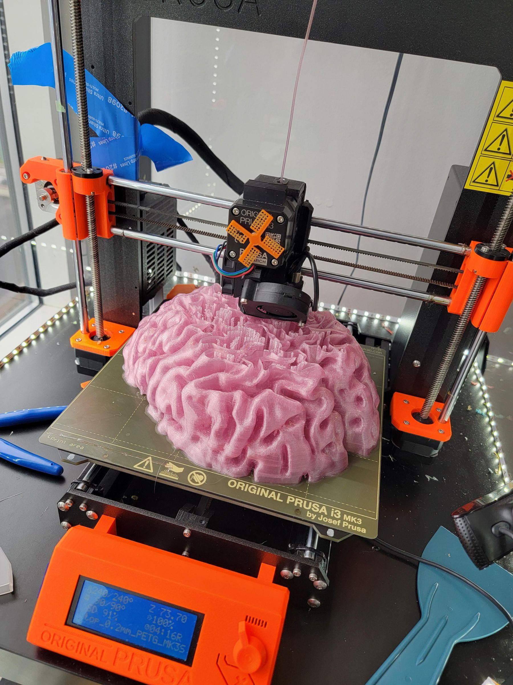 How To: From MRI to 3D Printed Brain Lamp : 4 Steps (with Pictures) - Instructables