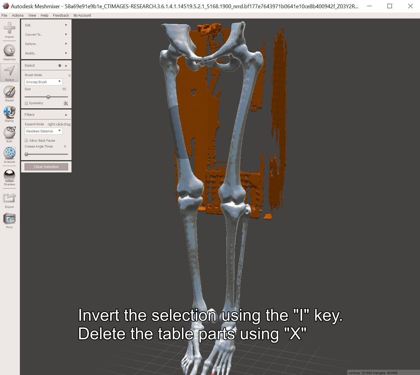 How to Easily and Automatically Convert a CT Scan (DICOM Data) Into a ...