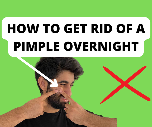 How to Get Rid of a Pimple Overnight : 5 Steps - Instructables