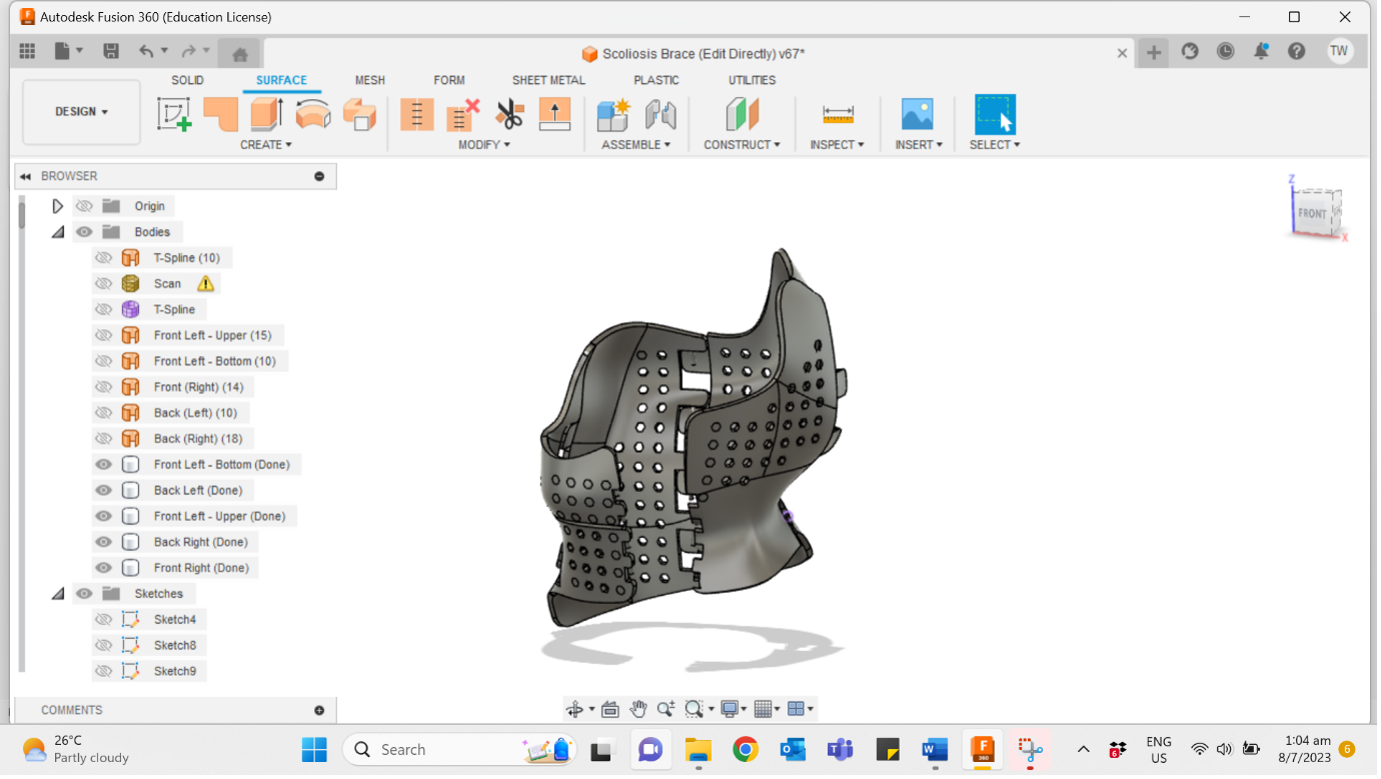 3D Printed Back Brace for Scoliosis : 7 Steps (with Pictures ...