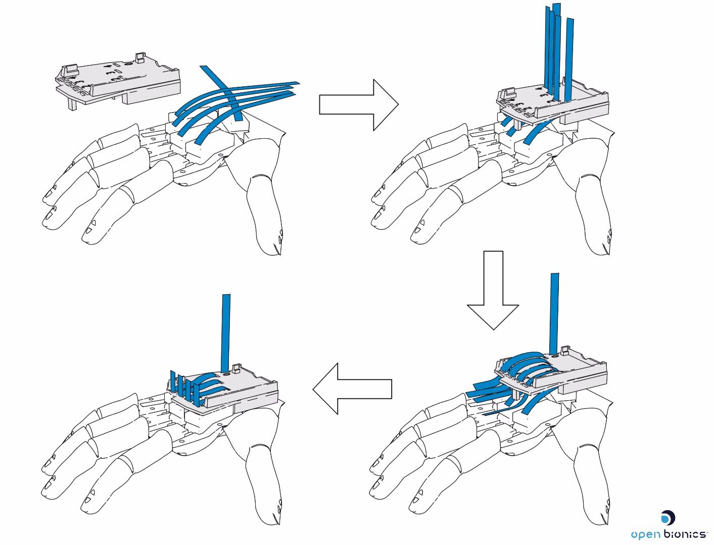 Ada Robotic Hand - Open Bionics : 8 Steps (with Pictures) - Instructables