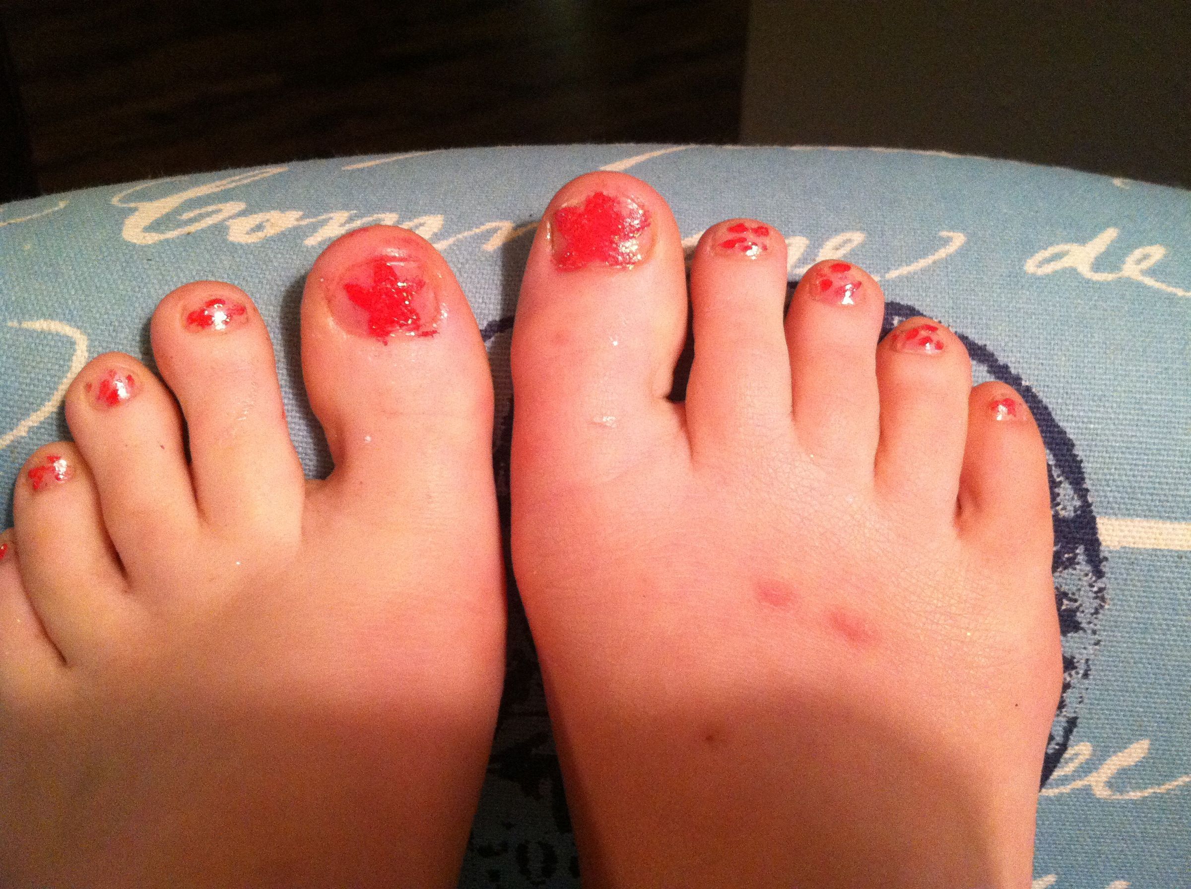 Starfish Toes : 6 Steps - Instructables