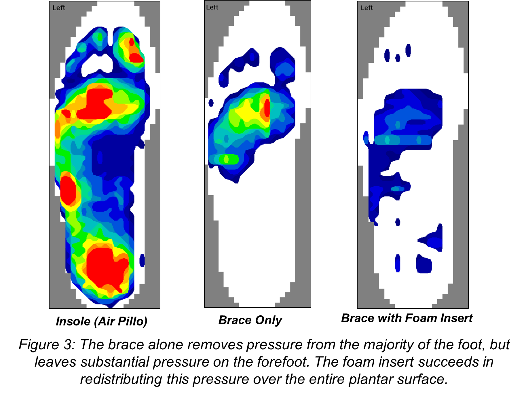 Improve the Toad Anti-Gravity Foot Brace ("TAG" Brace) : 6 Steps ...