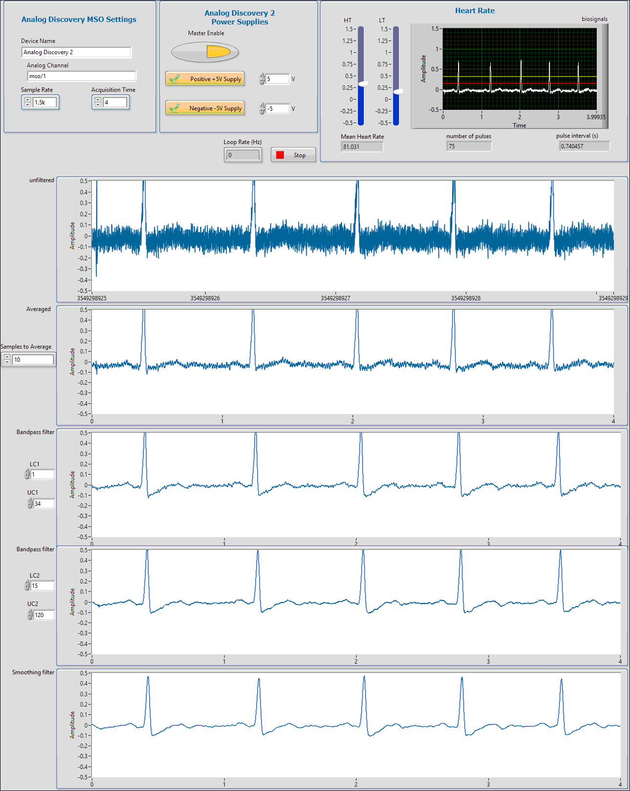 DIY ECG Using a Analog Discovery 2 and LabVIEW : 8 Steps - Instructables