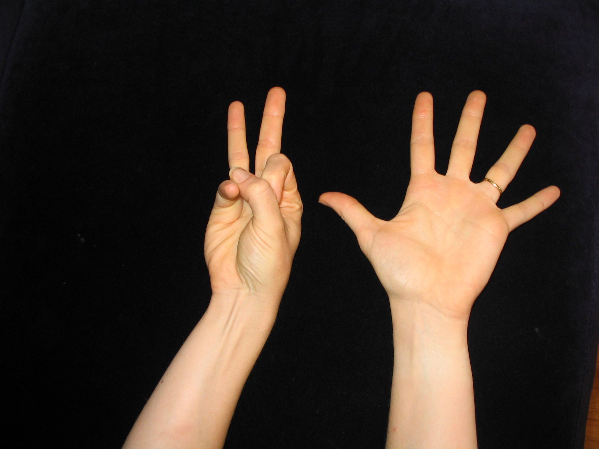 Mouse Toe Numbering Scheme : 5 Steps - Instructables