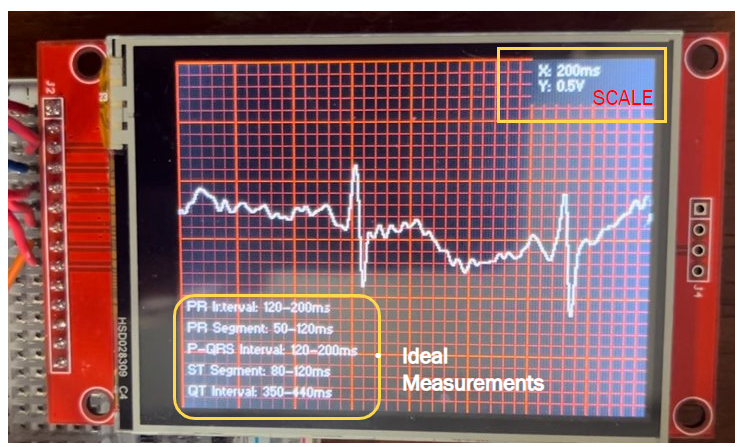ECG Display With Arduino : 13 Steps (with Pictures) - Instructables