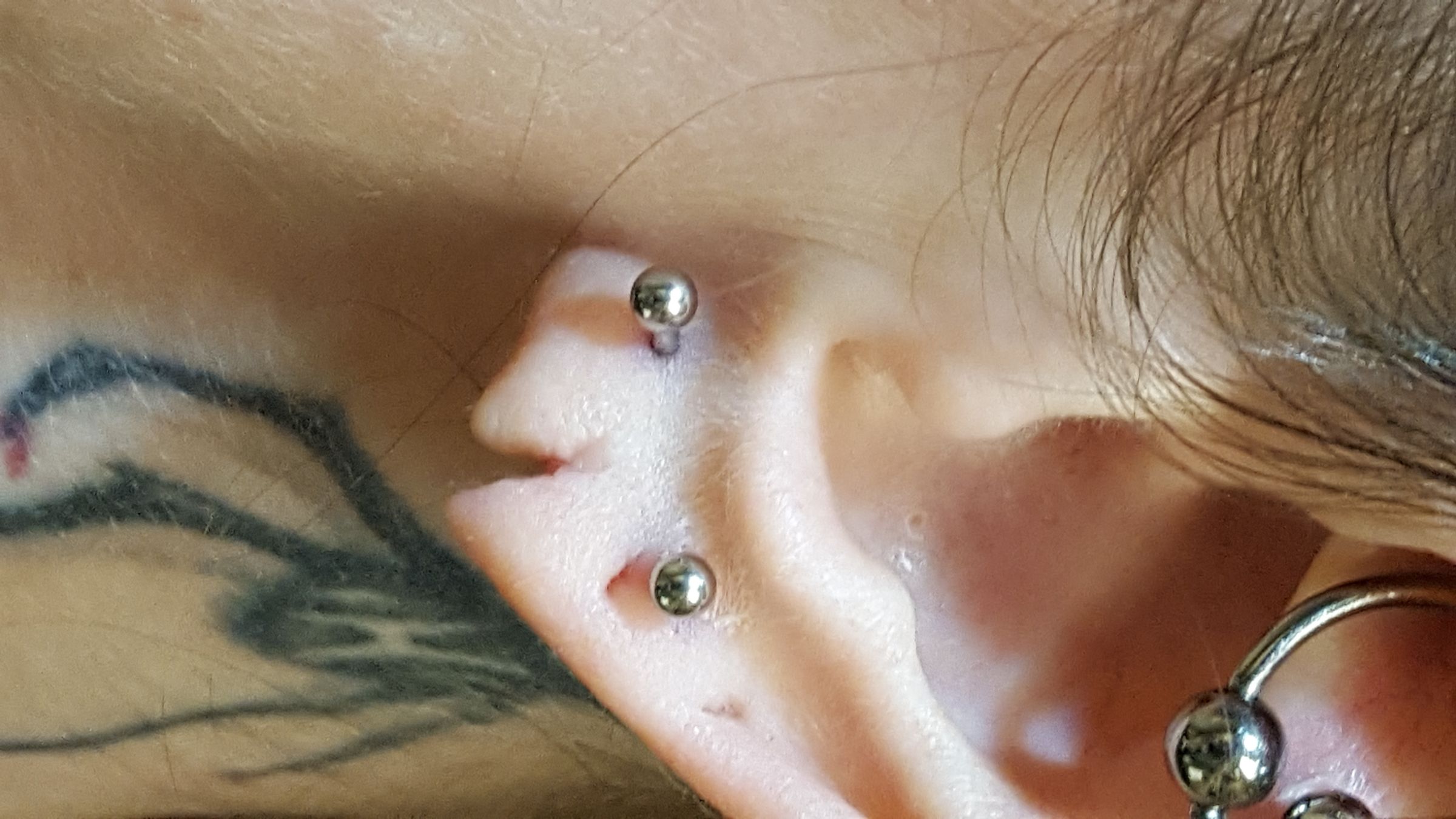 The First 3D Printed Prosthetic Stretched Lobe : 6 Steps (with Pictures ...