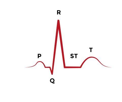 Electrocardiogram (ECG) Circuit : 5 Steps - Instructables