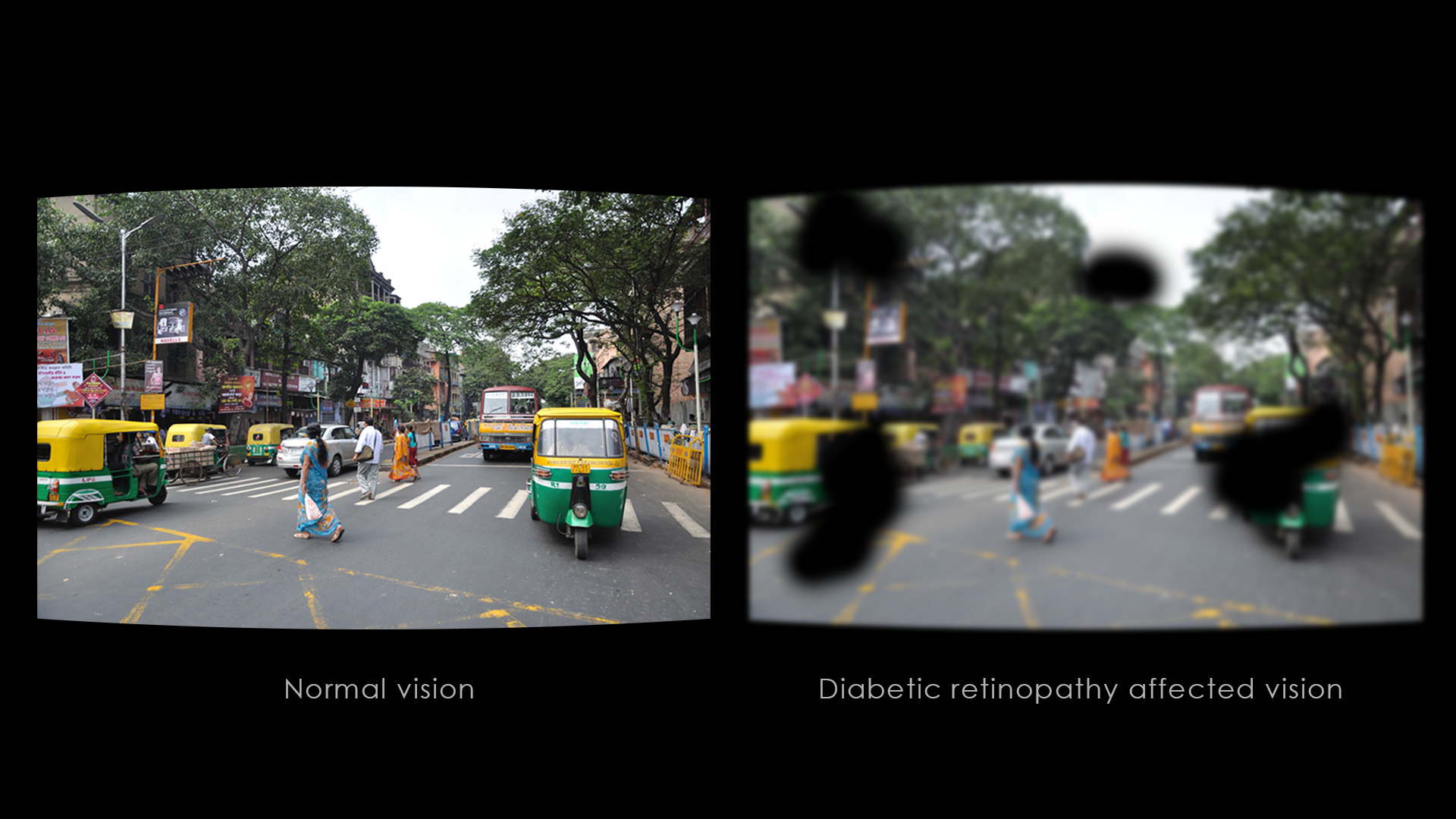 Open Indirect Ophthalmoscope (OIO) : 10 Steps (with Pictures ...