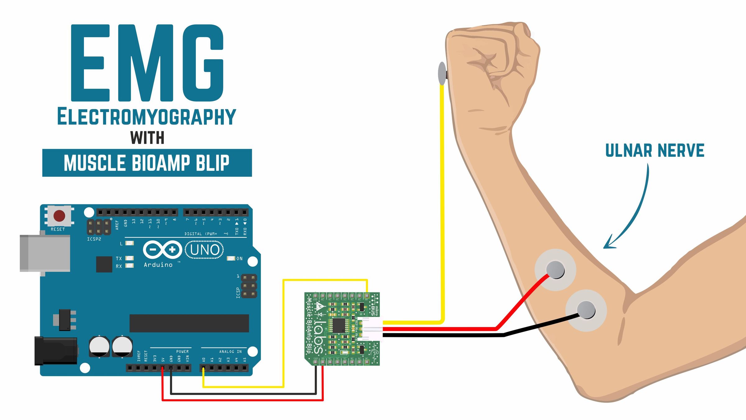 Record Muscle Signals (EMG) Using Muscle BioAmp Blip : 8 Steps - Instructables
