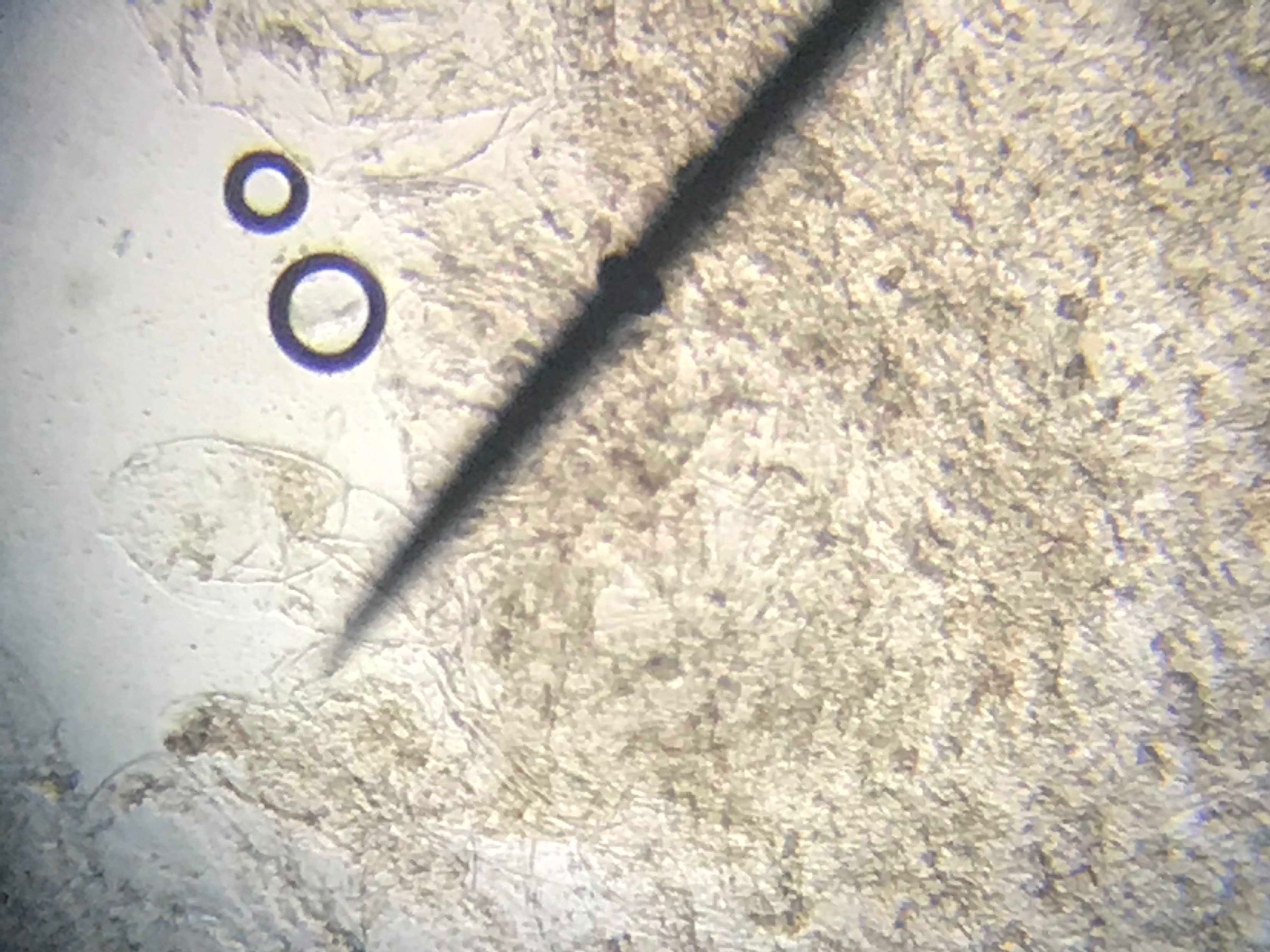 Strawberry Dna Under Microscope