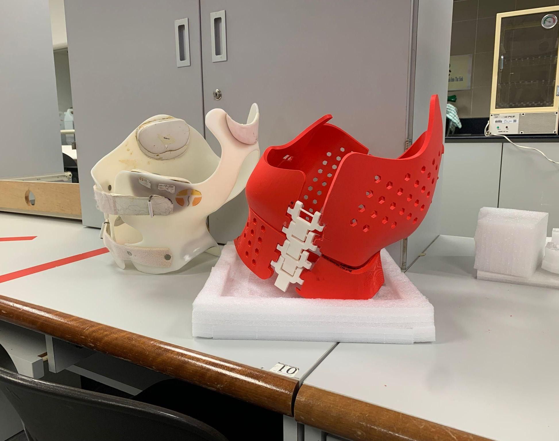 3D Printed Back Brace for Scoliosis : 7 Steps (with Pictures ...