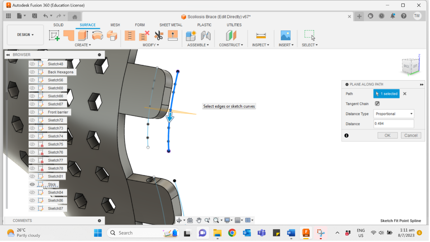 3D Printed Back Brace for Scoliosis : 7 Steps (with Pictures ...