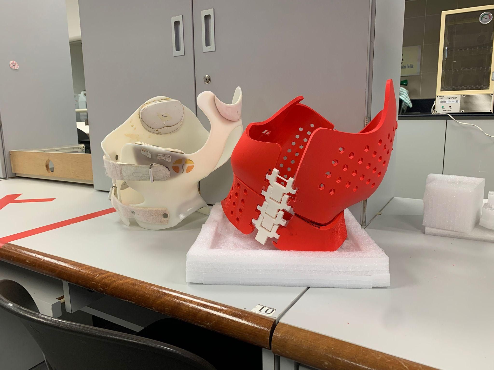 3D Printed Back Brace for Scoliosis : 7 Steps (with Pictures ...