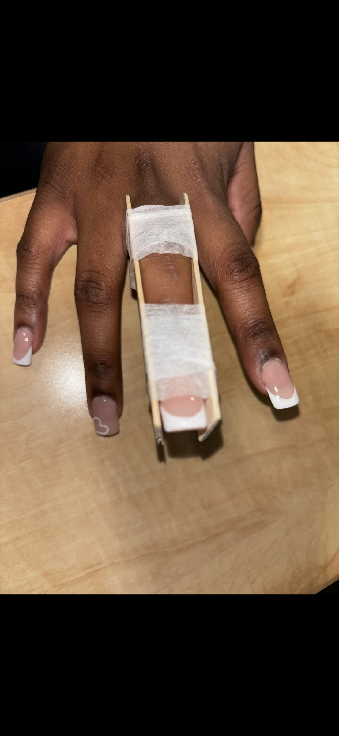 How to Splint a Finger at Home : 5 Steps - Instructables