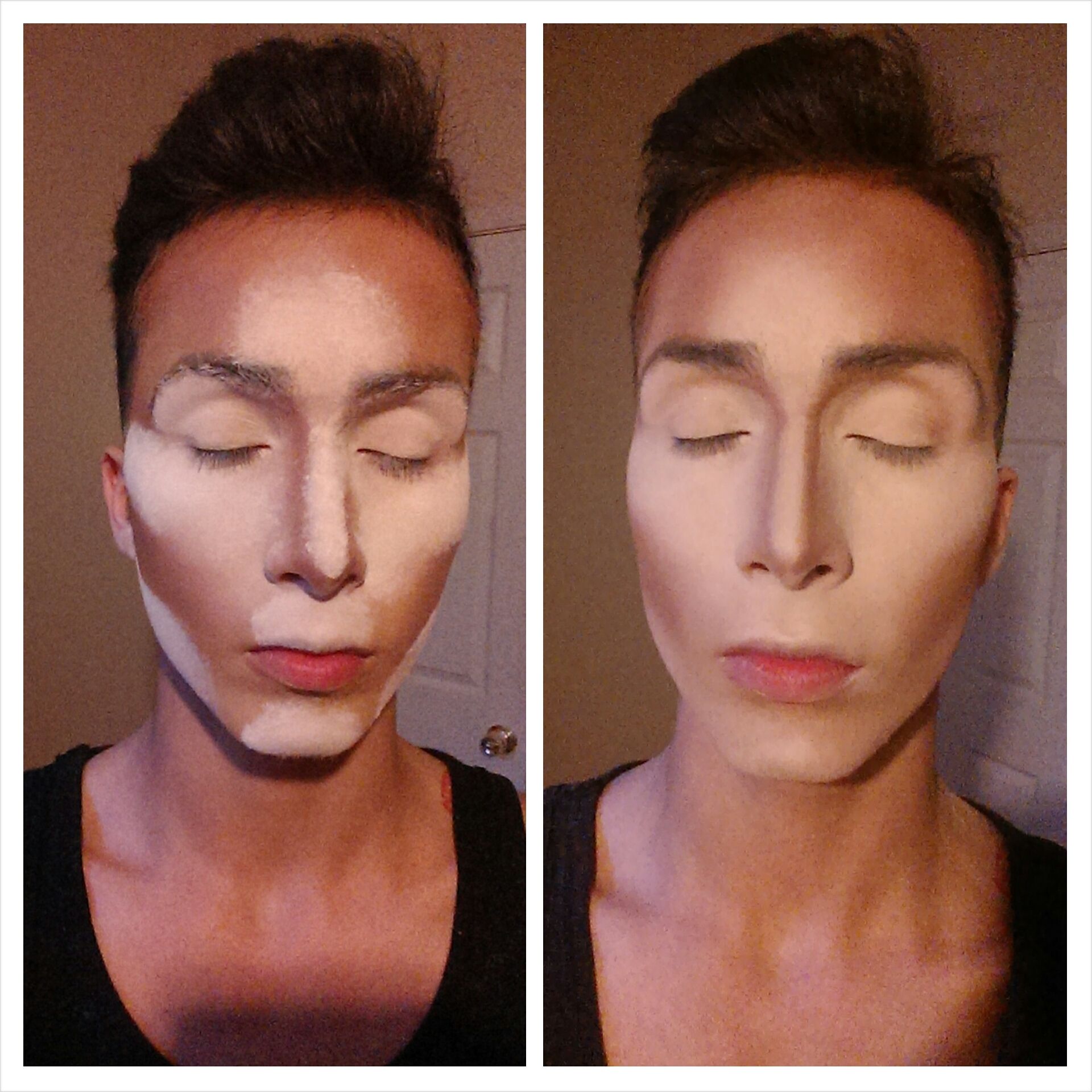 Male To Female Makeup Before And After Fibrous Dysplasia Before