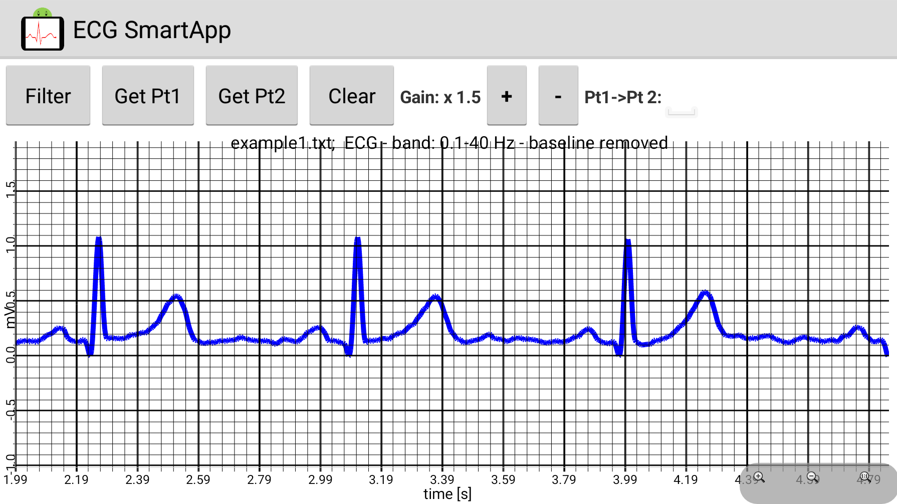 How to Build a Low Cost ECG Device : 27 Steps - Instructables