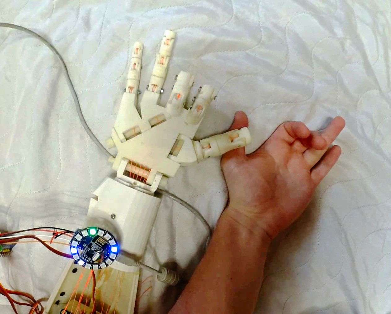 Robotic Hand Control With EMG : 7 Steps - Instructables