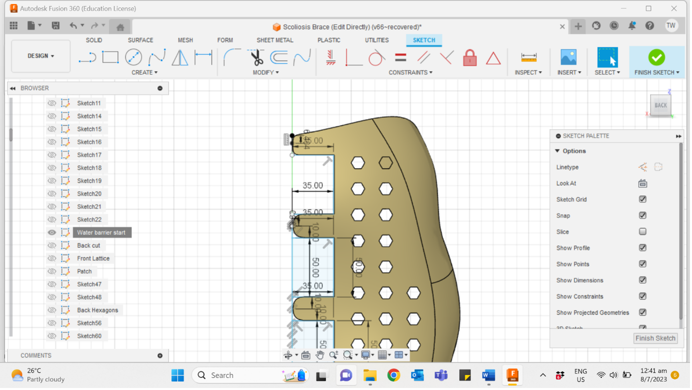 3D Printed Back Brace for Scoliosis : 7 Steps (with Pictures ...