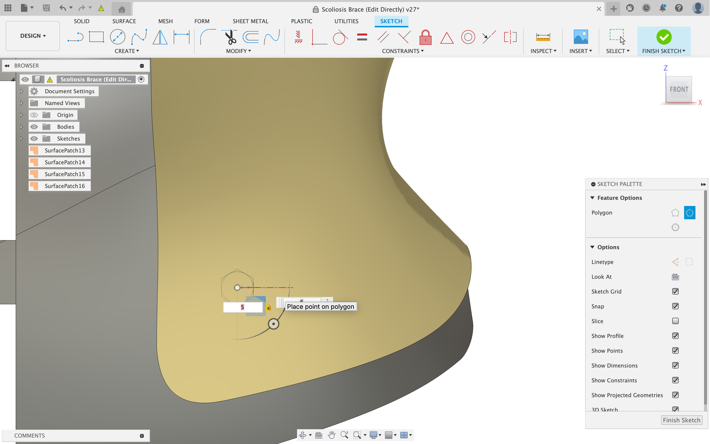 3D Printed Back Brace for Scoliosis : 7 Steps (with Pictures ...