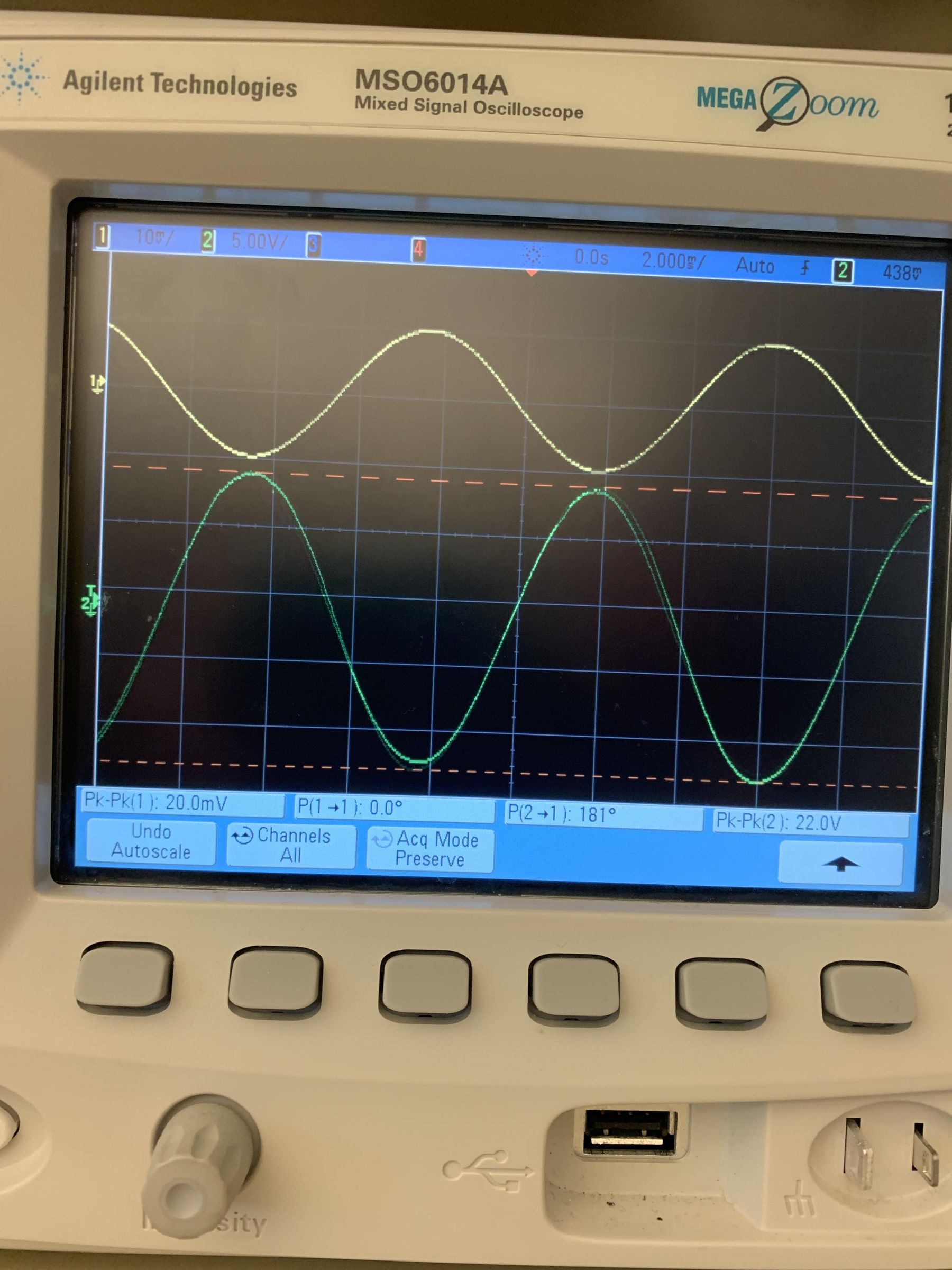 Intro: Breadboard EKG : 7 Steps - Instructables