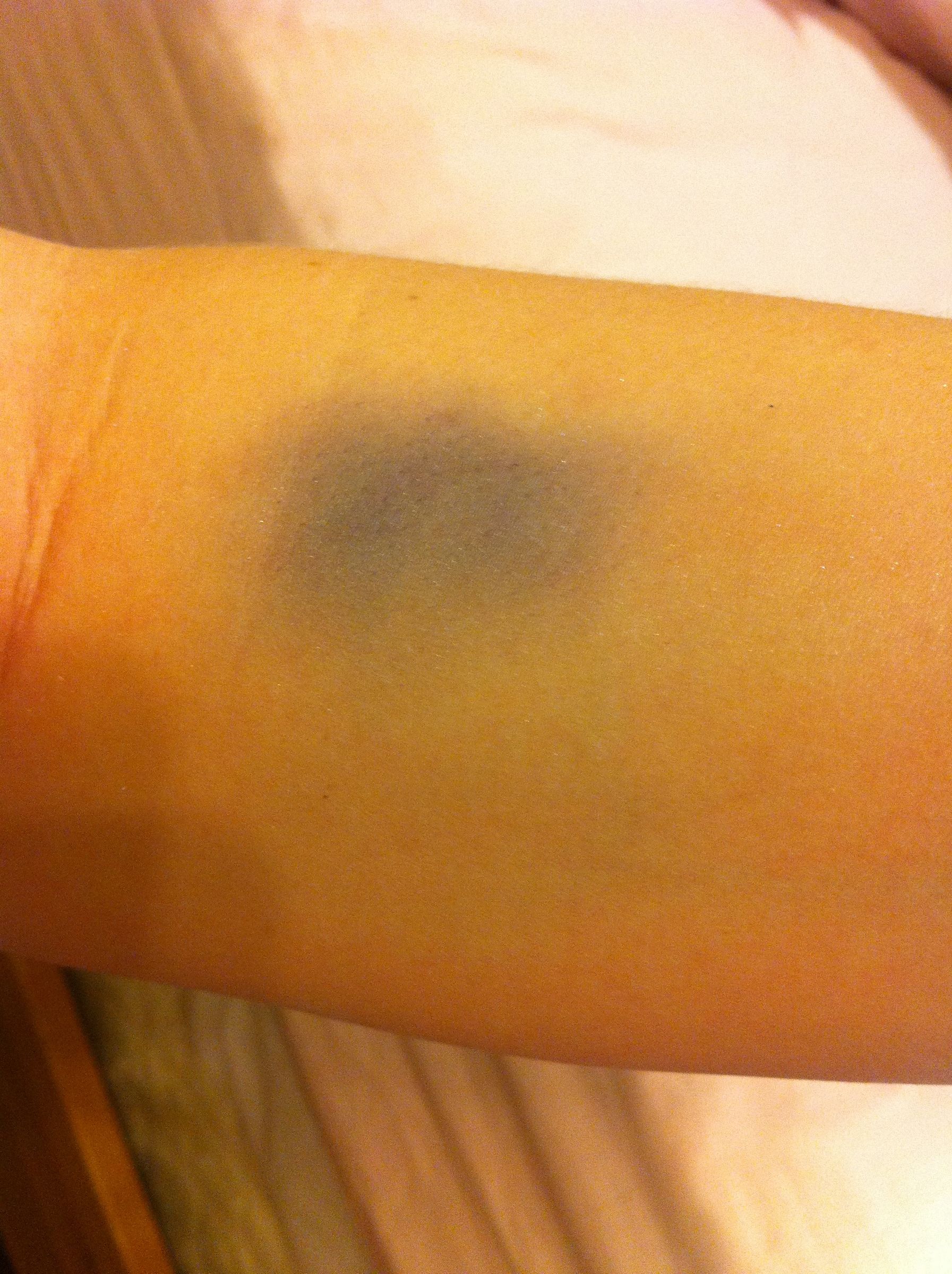 How to Create a Fake Bruise : 6 Steps - Instructables
