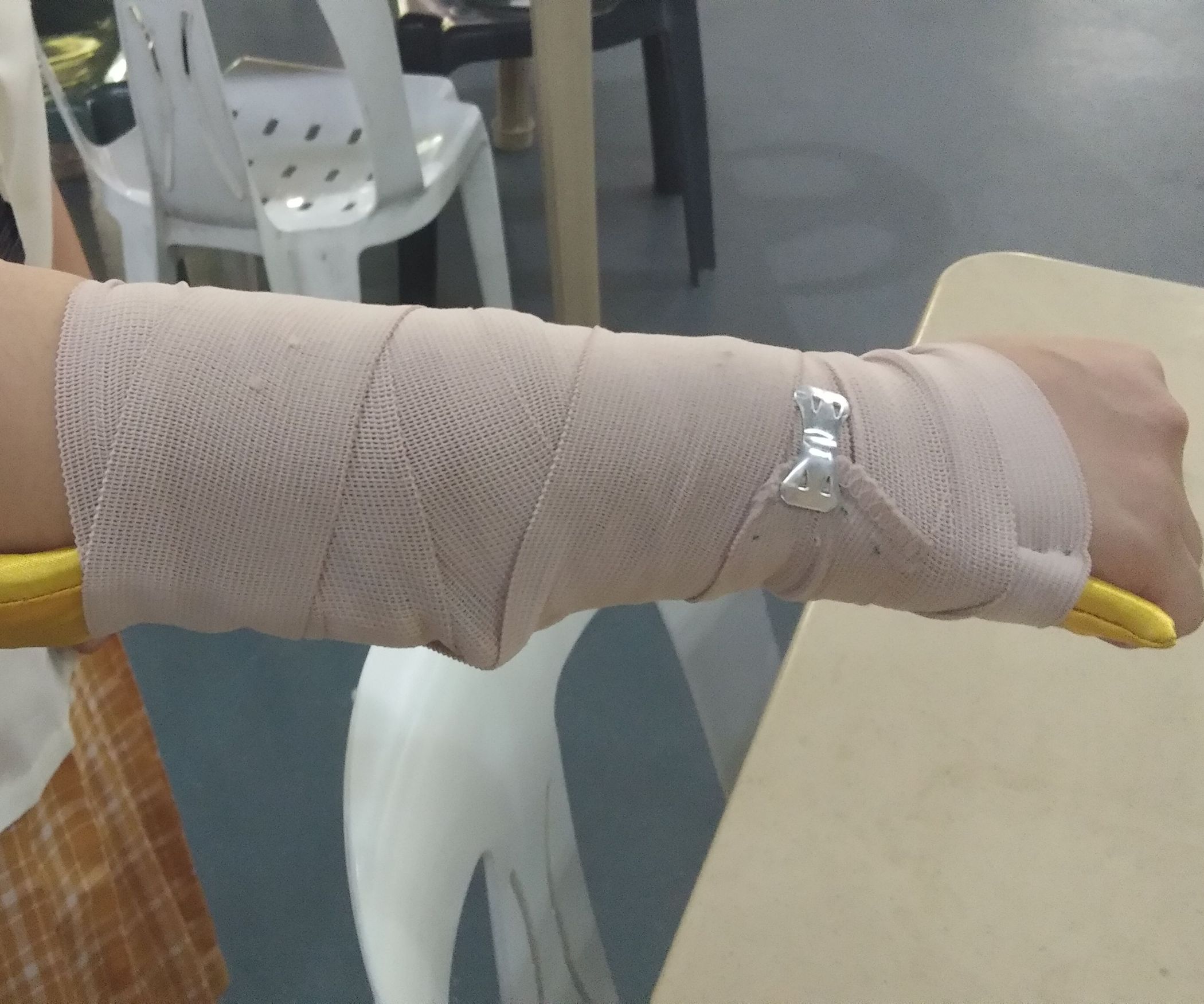 Rollable Splint : 6 Steps - Instructables