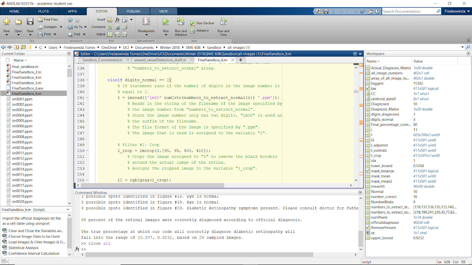 Automated Diagnosis of Diabetic Retinopathy Via MATLAB : 33 Steps ...