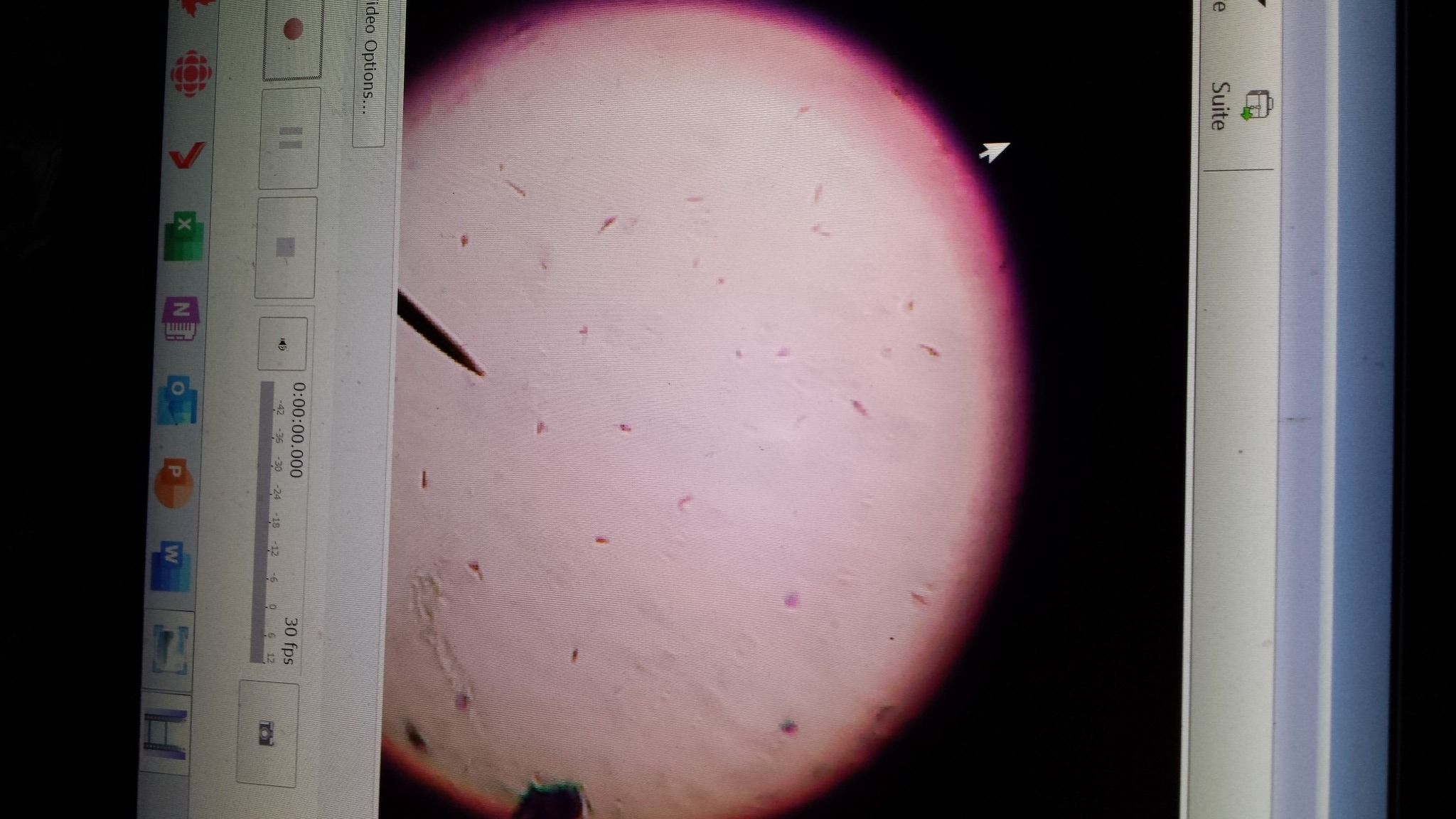 Seeing Spores From Bacteria With an Polarized Microscope! : 5 Steps ...