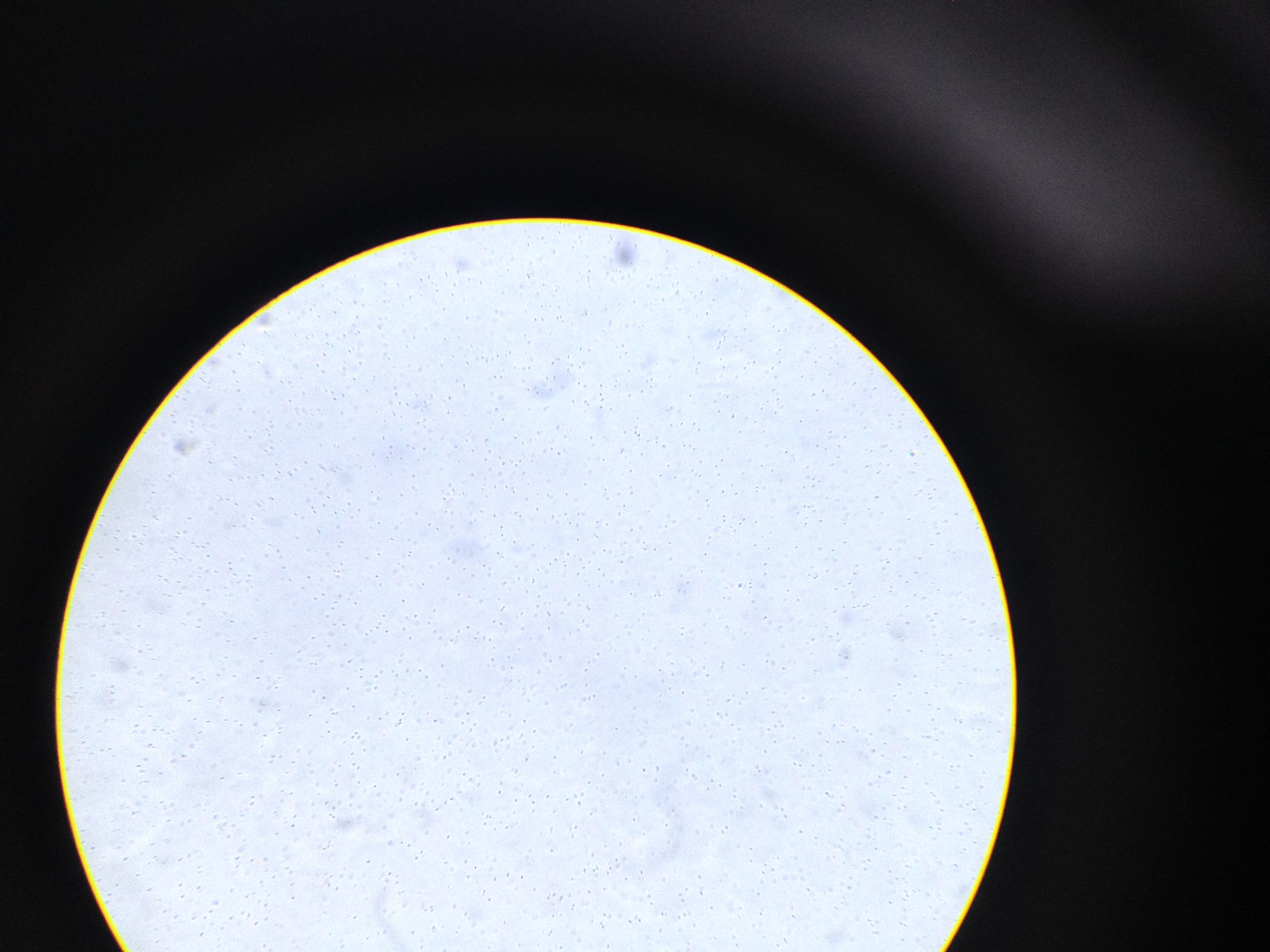Bacteria - Bacillus Clausii: Observe With Microscope - Instructables