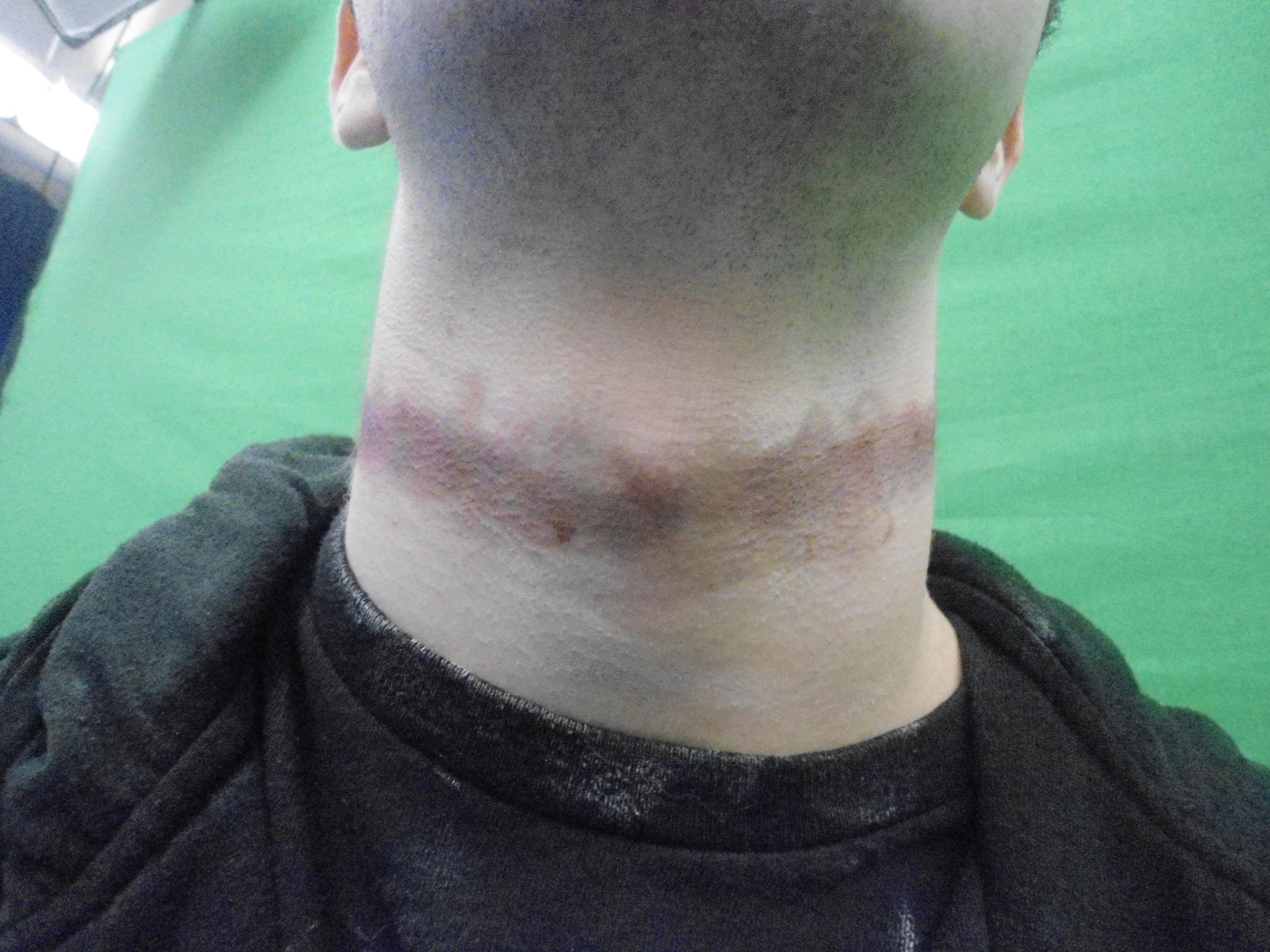 How to Create a Hanged Corpse : 10 Steps - Instructables