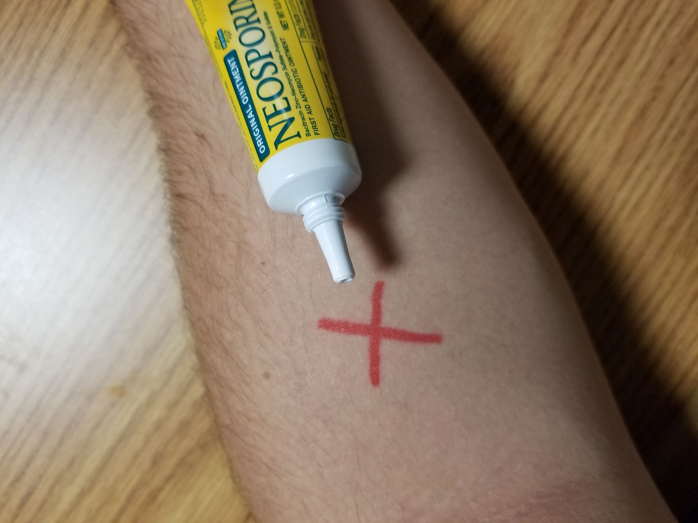 How to Bandage Your Own Wound : 8 Steps - Instructables