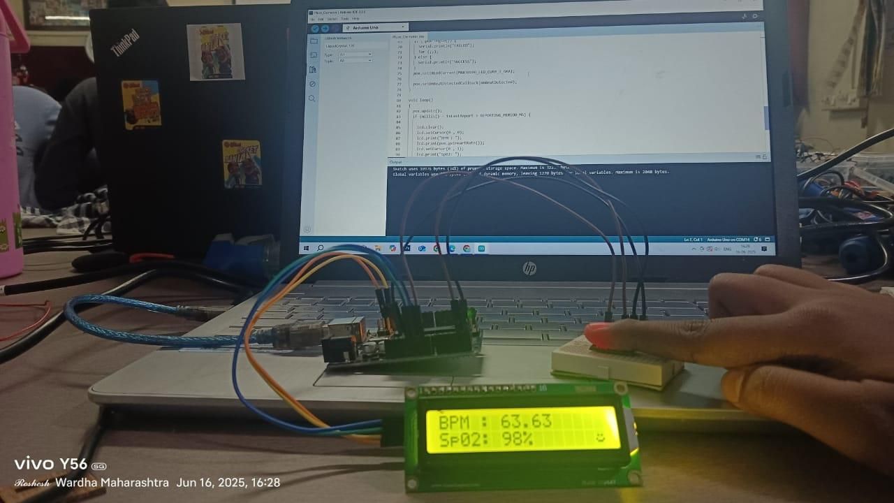 🩺Oximeter Using Arduino – a DIY Health Monitoring Project : 4 Steps ...