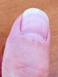 How to Repair a Cracked Fingernail : 4 Steps - Instructables