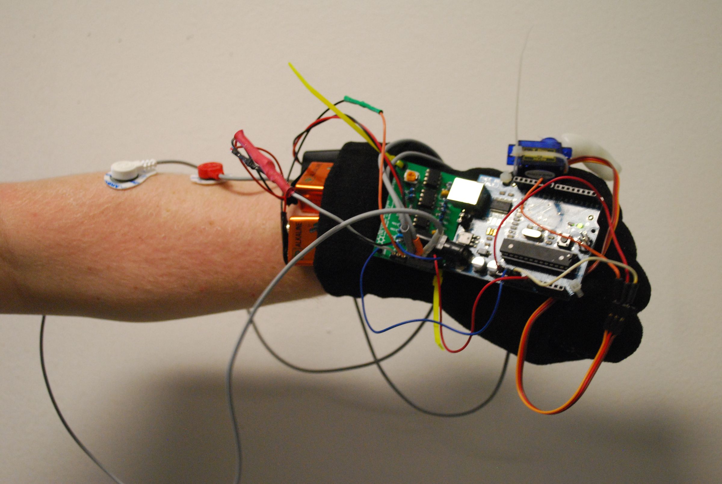 Transhumanist Appendage Addition Device (with Pictures) - Instructables