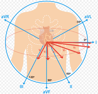 The Do-It-Yourself Electrocardiogram (ECG) : 6 Steps - Instructables