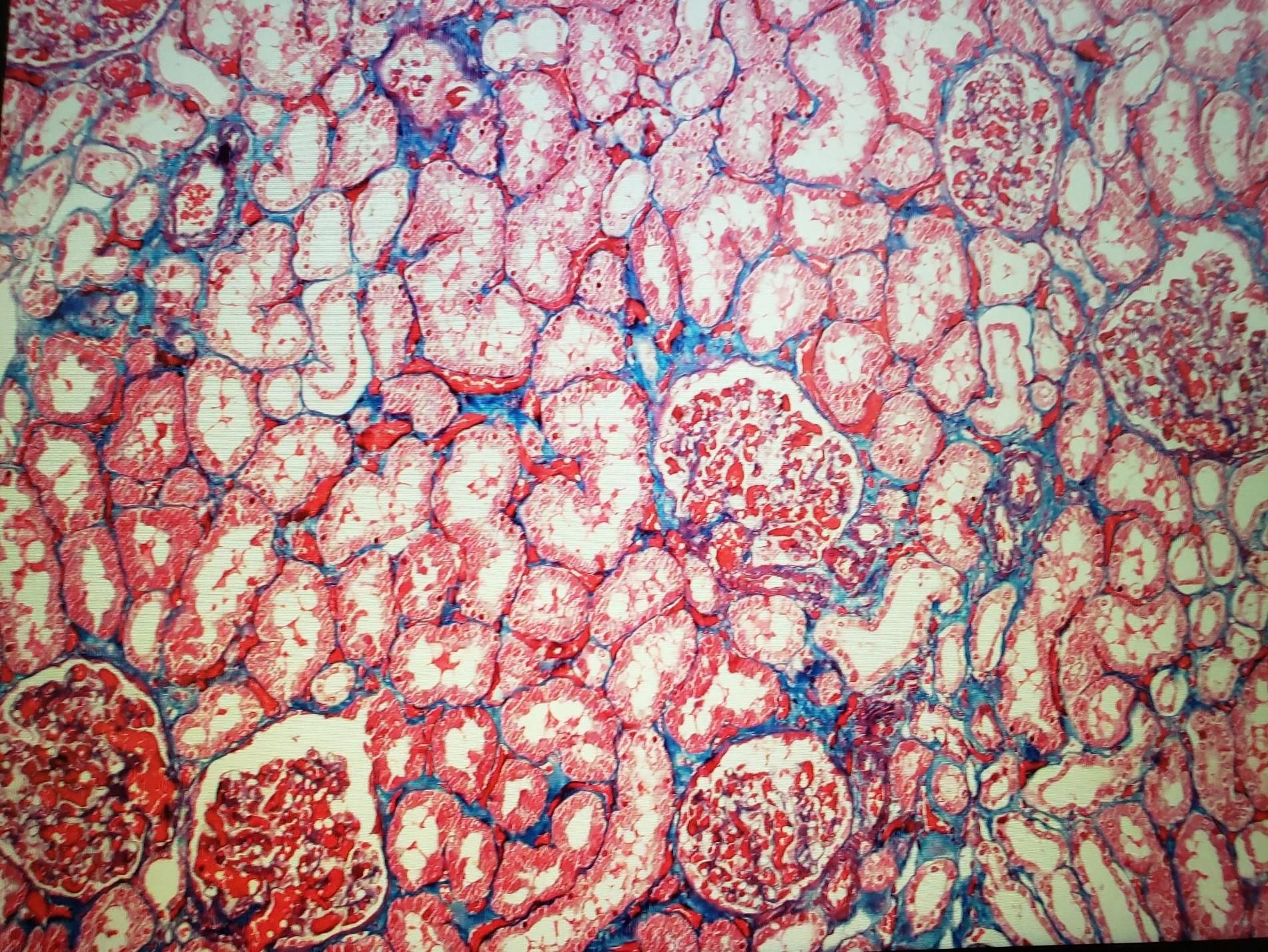 How to Change a Leica and Thermo Stainer : 25 Steps - Instructables
