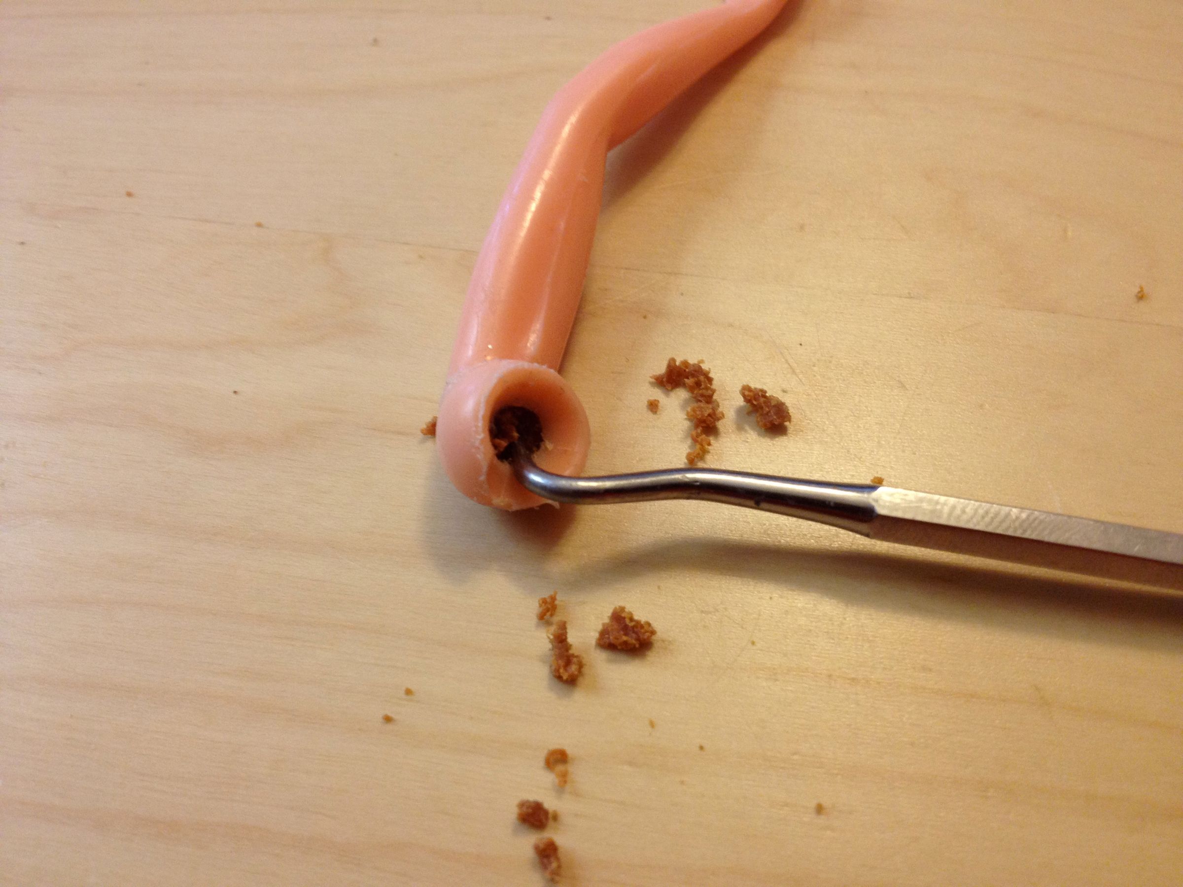 Bionic Barbie A.k.a. "shoulder Replacement Surgery" : 5 Steps (with ...