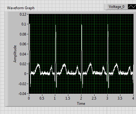 How to Build an ECG and Heart Rate Digital Monitor : 6 Steps ...