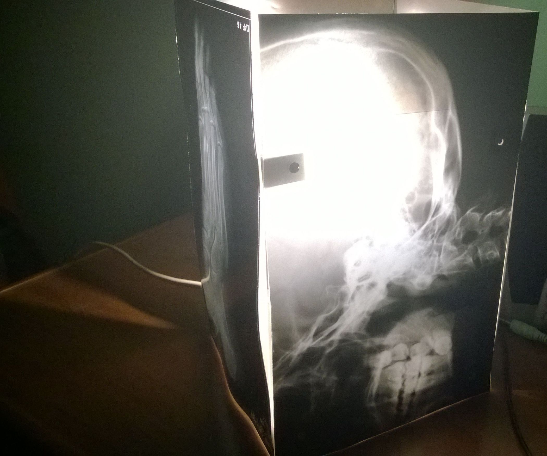 Radiographic Lamp : 6 Steps (with Pictures) - Instructables
