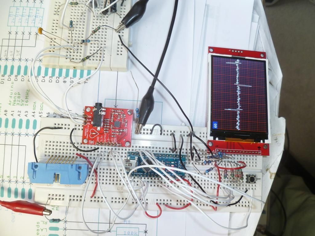 ECG Display With Arduino : 13 Steps (with Pictures) - Instructables
